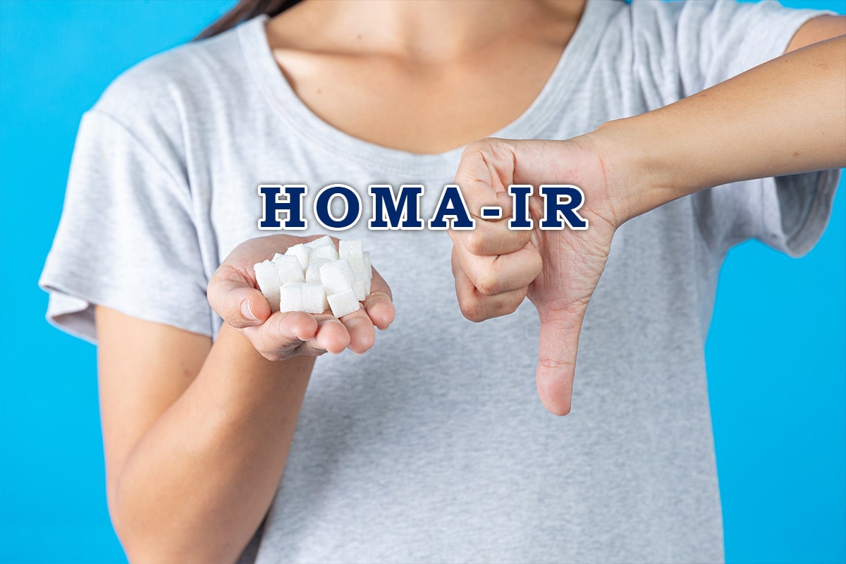 İNSÜLİN DİRENCİ (HOMA-IR) - Pasteur Lab